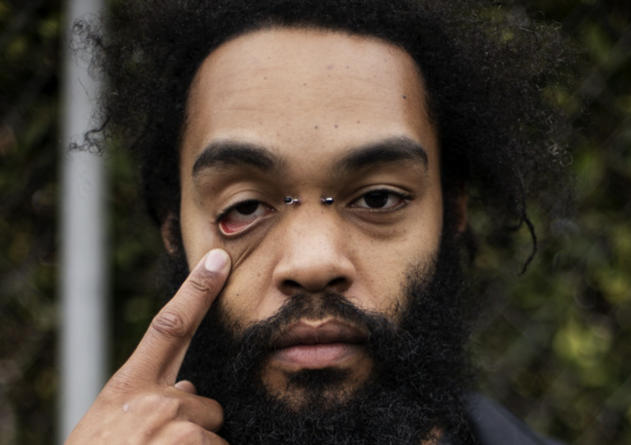 Zeroh - The Masquerade